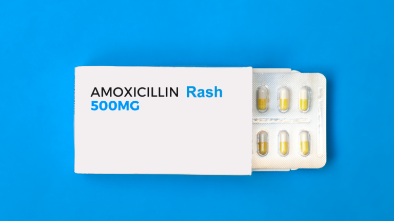 Everything You Need To Know About An Amoxicillin Rash | Umedoc ...